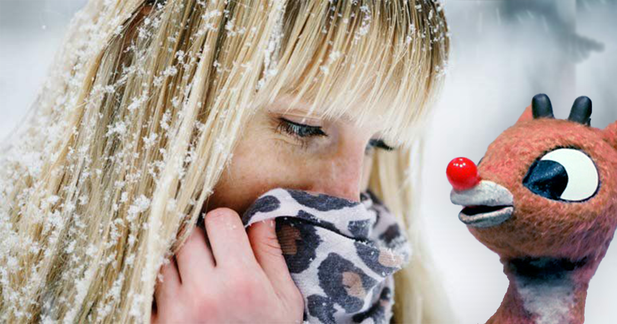 Rosacea: Leave the Red Nose to Rudolph! - Apex Skin