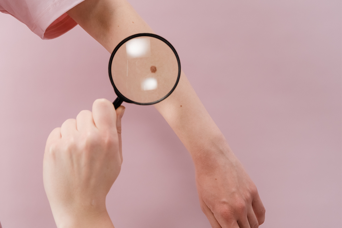 Never Neglect Skin Health | Apex Skin Insights