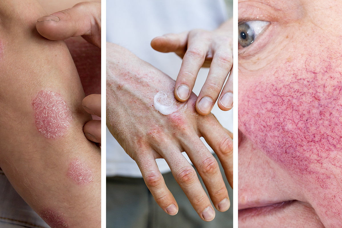 General Dermatology: Skin Dermatology| Hair, Nail, Skin Care treatment