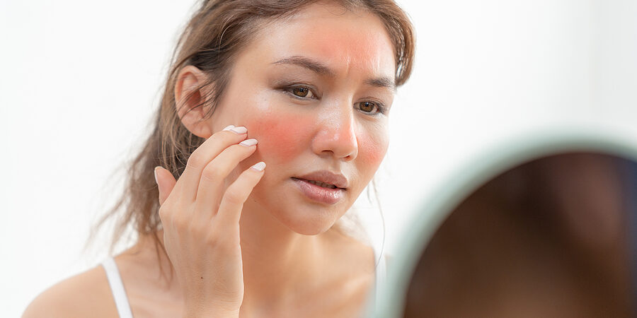 Post-Sun Recovery: How to Repair Sun-Damaged Skin